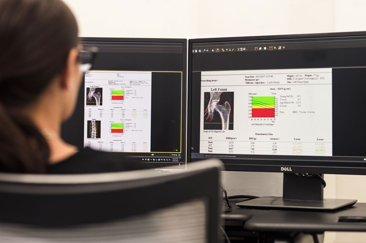 Bone Mineral Densitometry (BMD) Scan | Queensland X-Ray